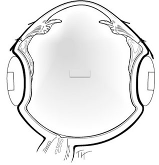 Retinal Disease Management - Georgia Eye Institute